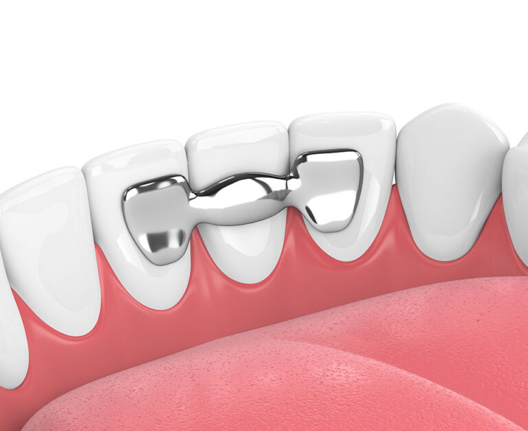 Home- Let us brighten your smile- Smile Plus Mn